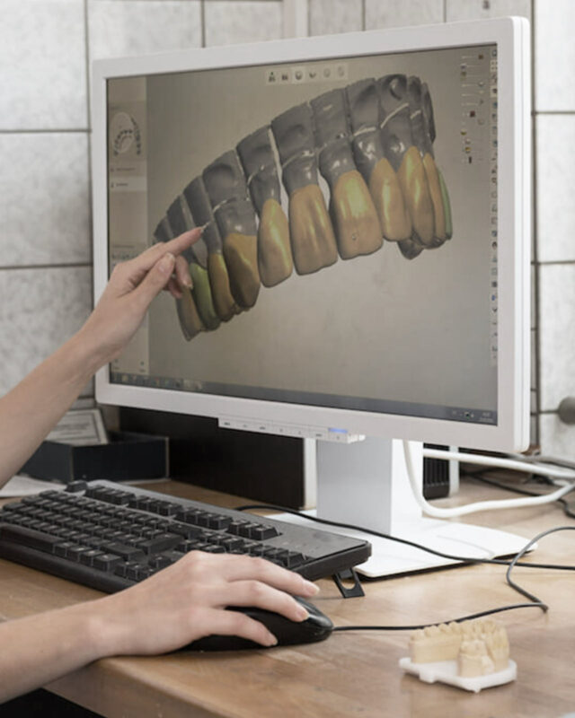 Primo Lab - Caredent